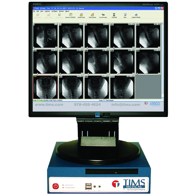 tims - SST Group Inc.